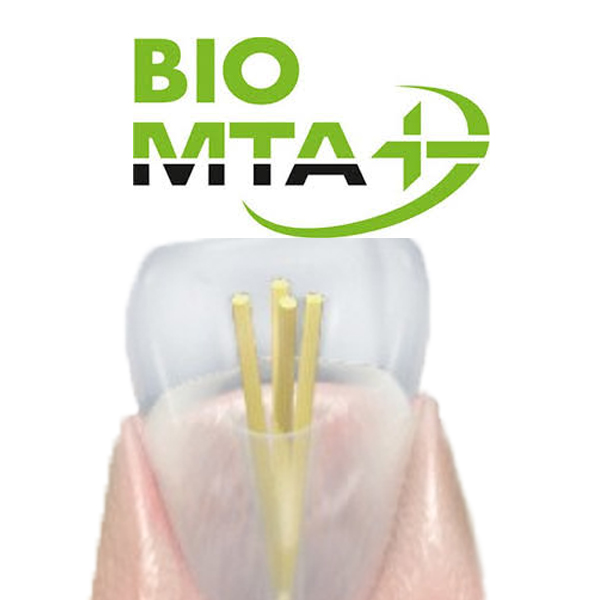 Posts, MTA and other endo products
